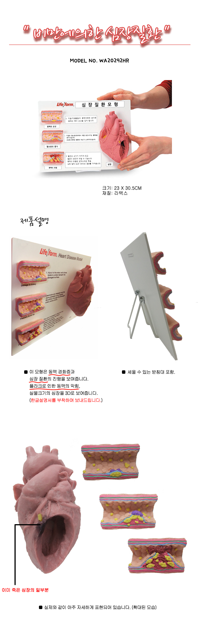 비만에 의한 심장질환모형(WA20292) - 에듀테크의 중심 (주)아리수에듀